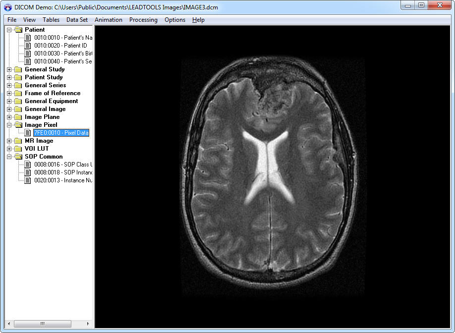 Leadtools Pacs Imaging Sdk
