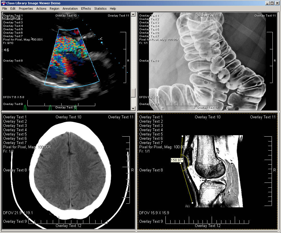 LEADTOOLS PACS Imaging SDK