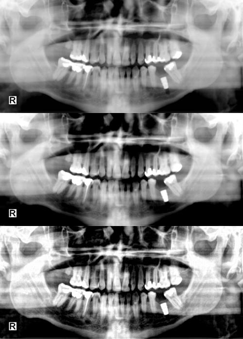 Leadtools Pacs Imaging Sdk
