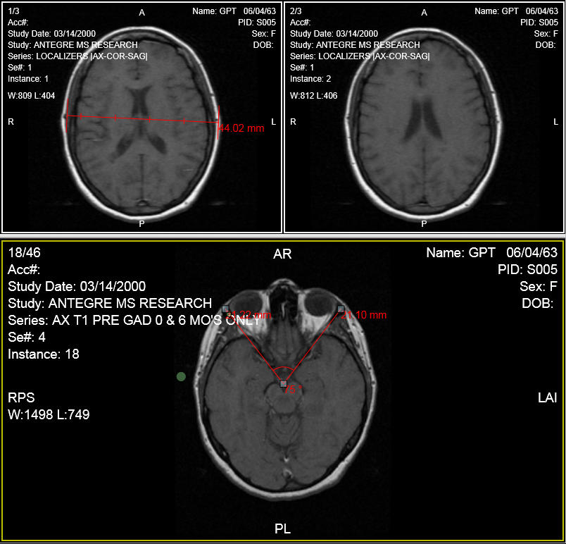 Leadtools Pacs Imaging Sdk