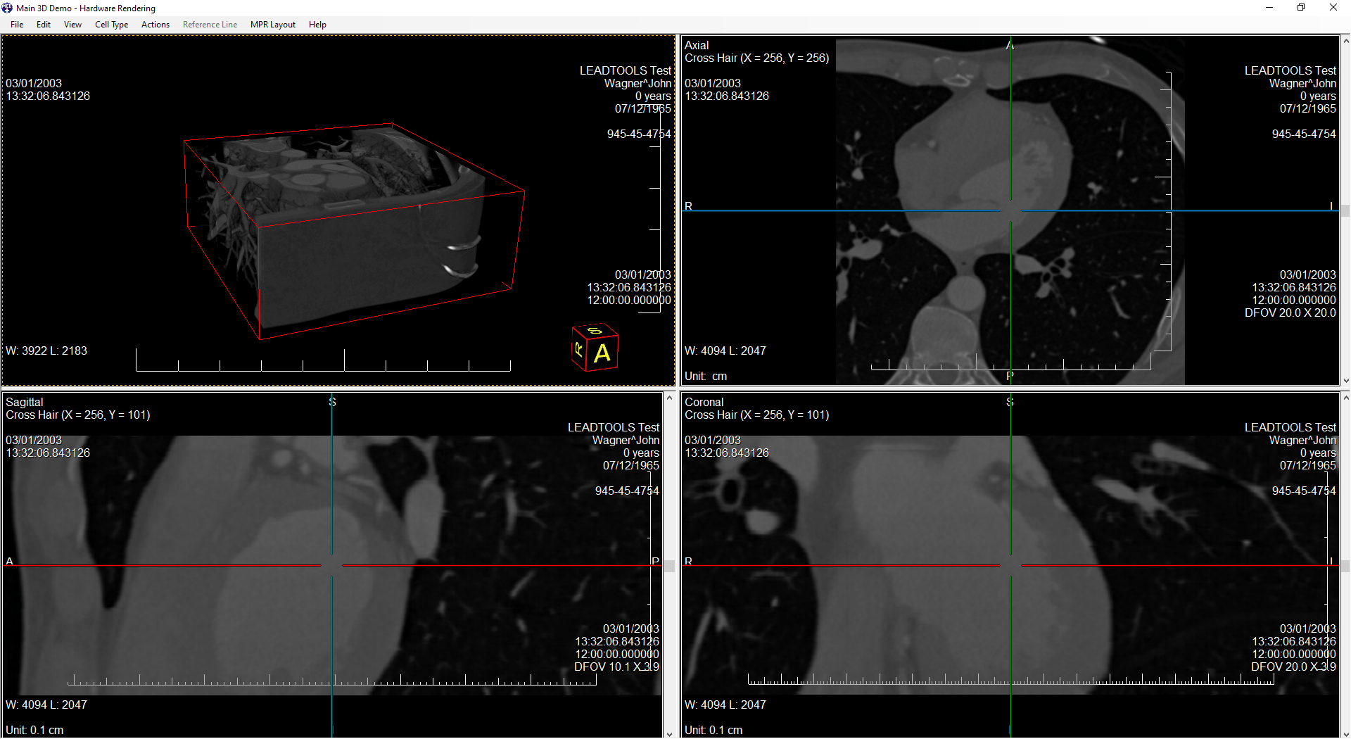 LEADTOOLS Medical Suite SDK（英語版）