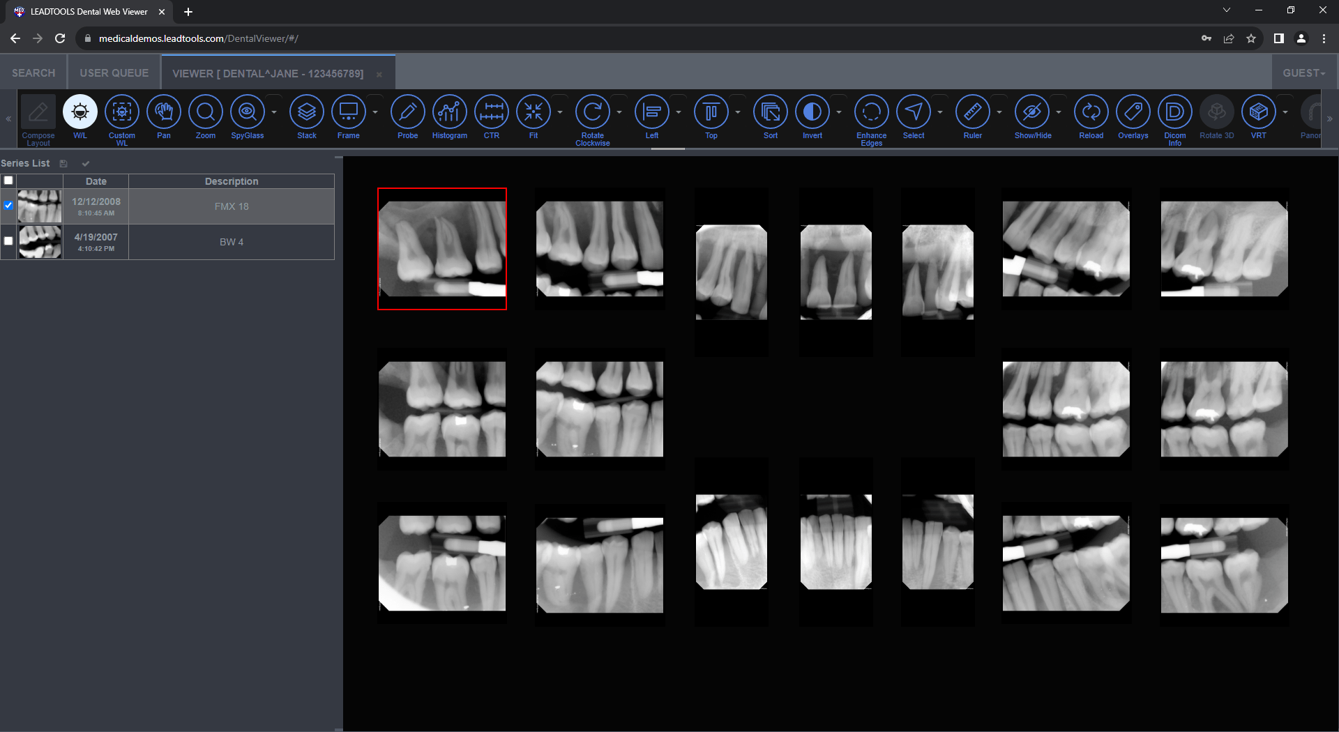 LEADTOOLS Medical Suite SDK
