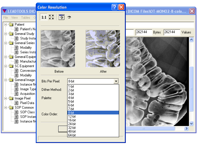 LEADTOOLS Medical SDK