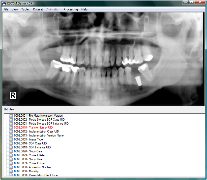 LEADTOOLS PACS Imaging SDK