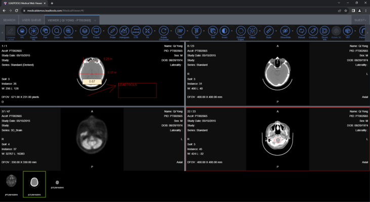View And Annotate Dicom Images