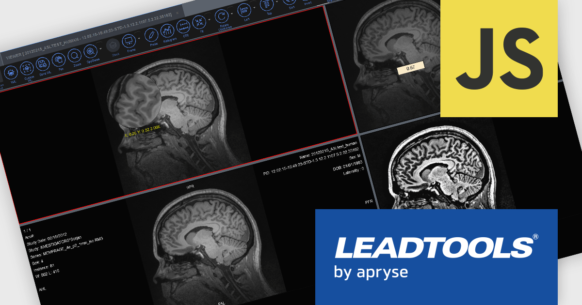 View DICOM Images with 3D Volume Rendering