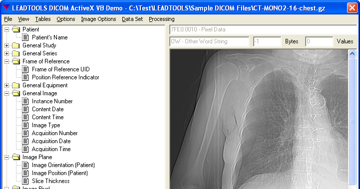 LEADTOOLS Medical Imaging 17.0 released