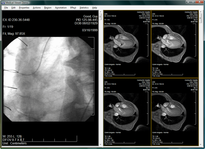 Leadtools Pacs Imaging Sdk